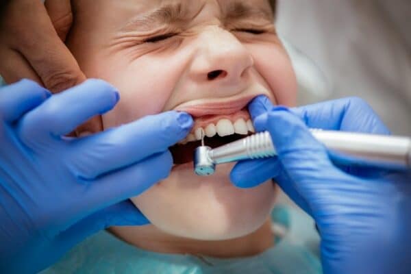 Common Dental Procedures Performed by Dentists - Ice Cream n Sticky Fingers